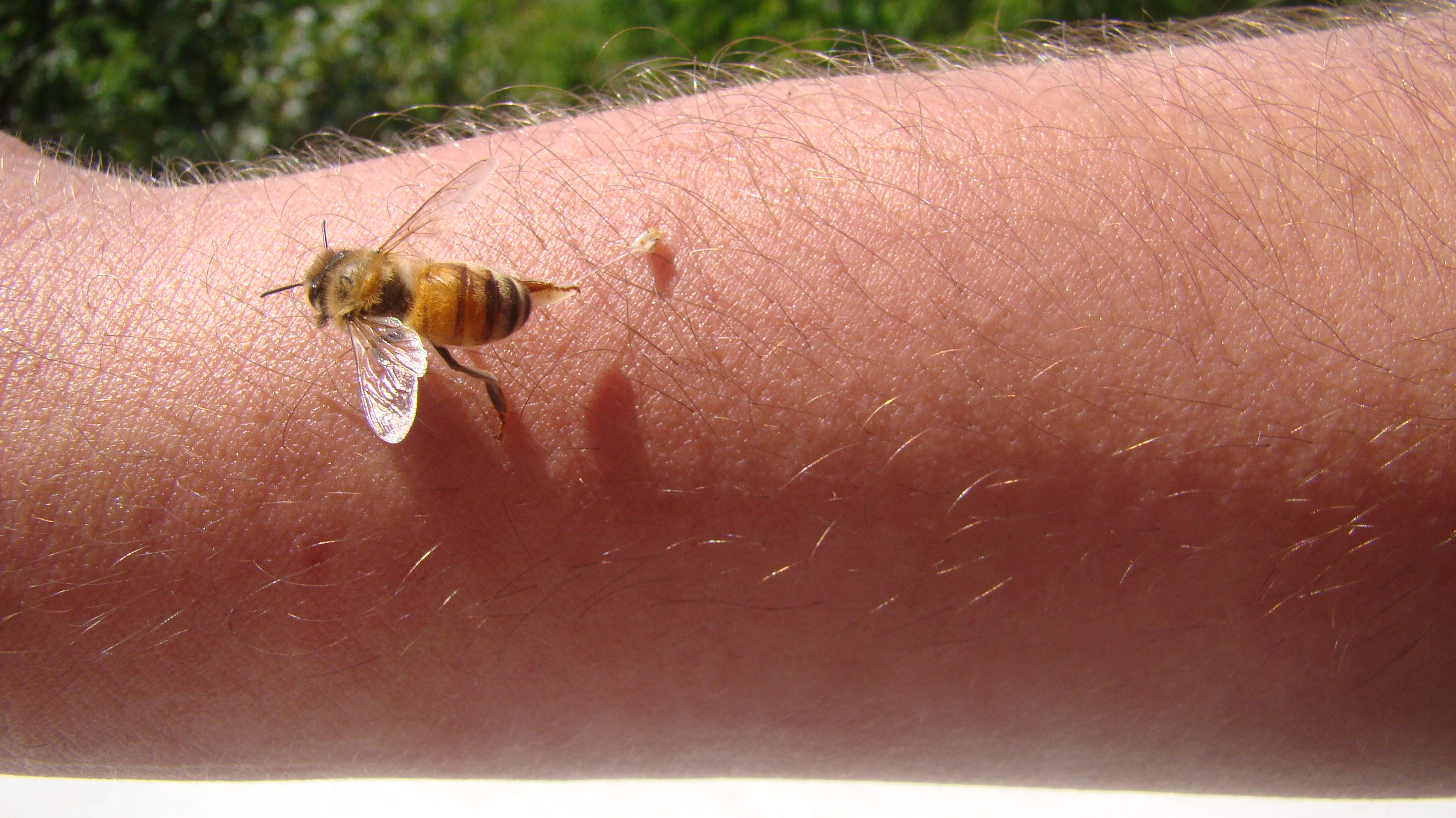 3 Tips for What to Do If You Get a Bee Sting